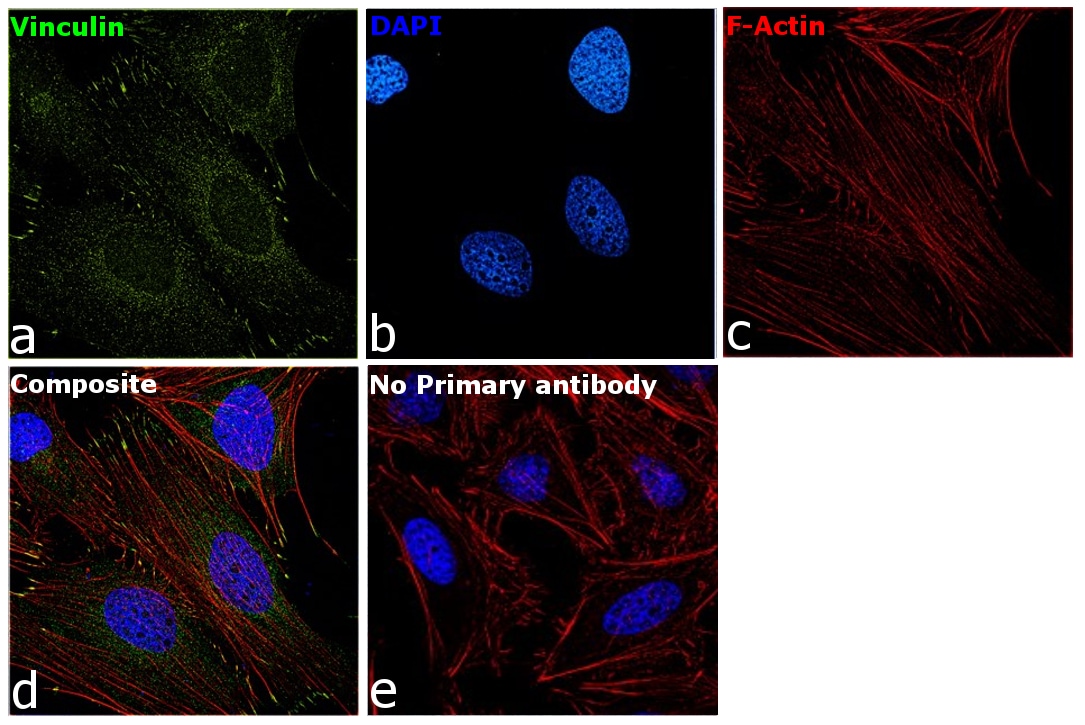 Vinculin Antibody (700062)