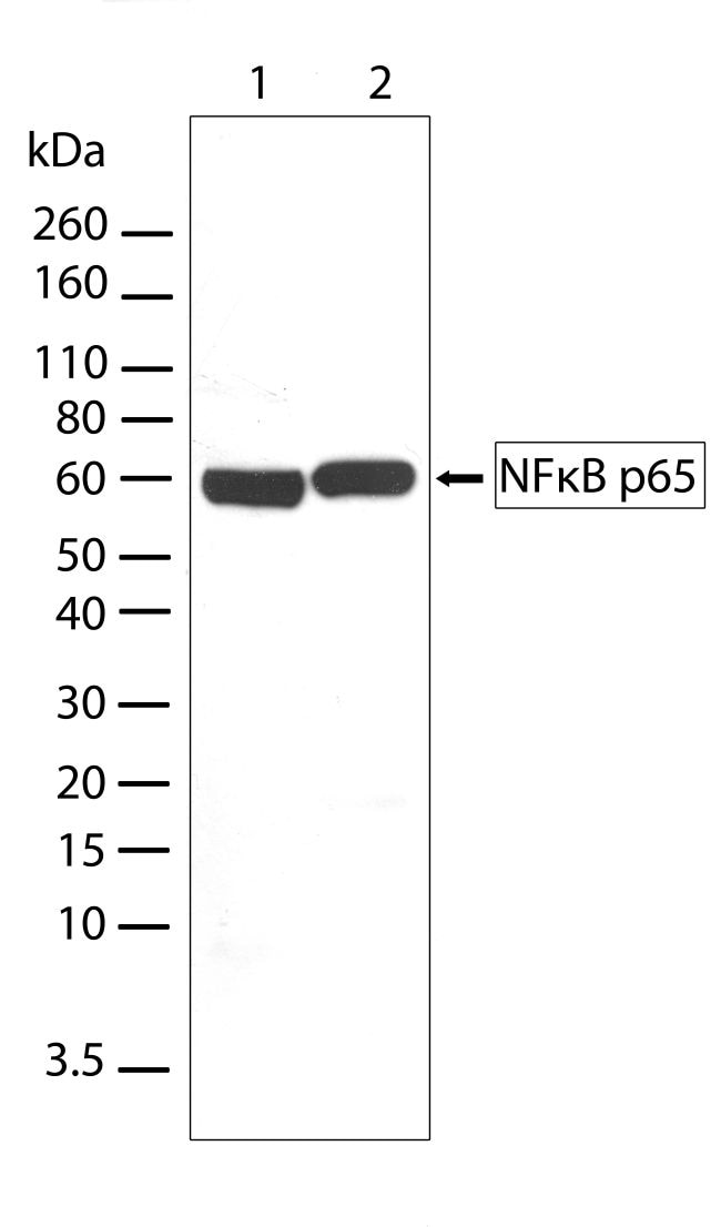 NFkB p65 Antibody (701079)