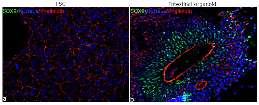 SOX9 Antibody (702016)