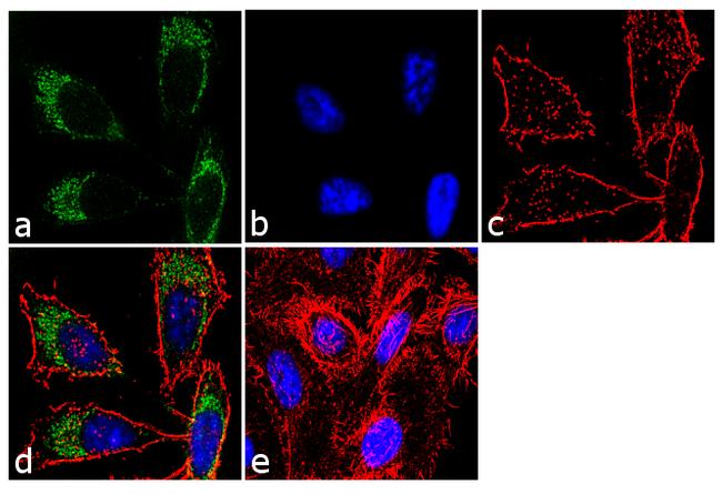 FKBP5 Antibody (702260)