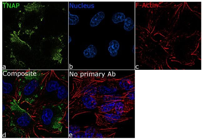 ALPL Antibody (702454)