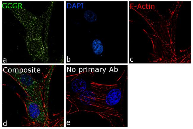 Glucagon Receptor Antibody (702602)