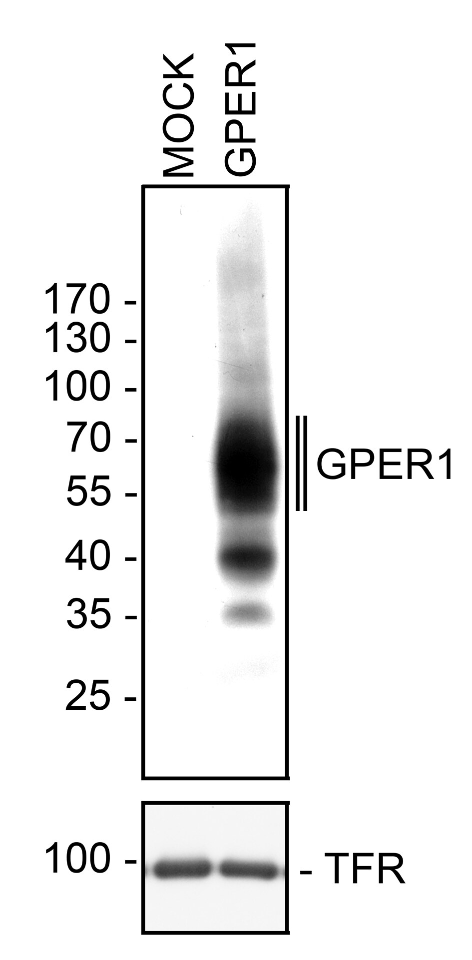 GPR30 Antibody (703480)