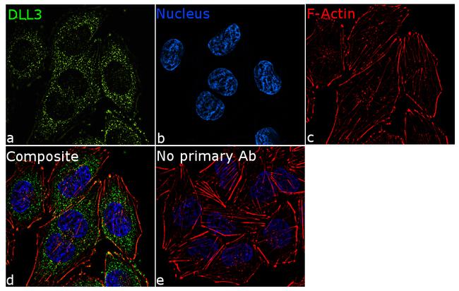 DLL3 Antibody (703623)
