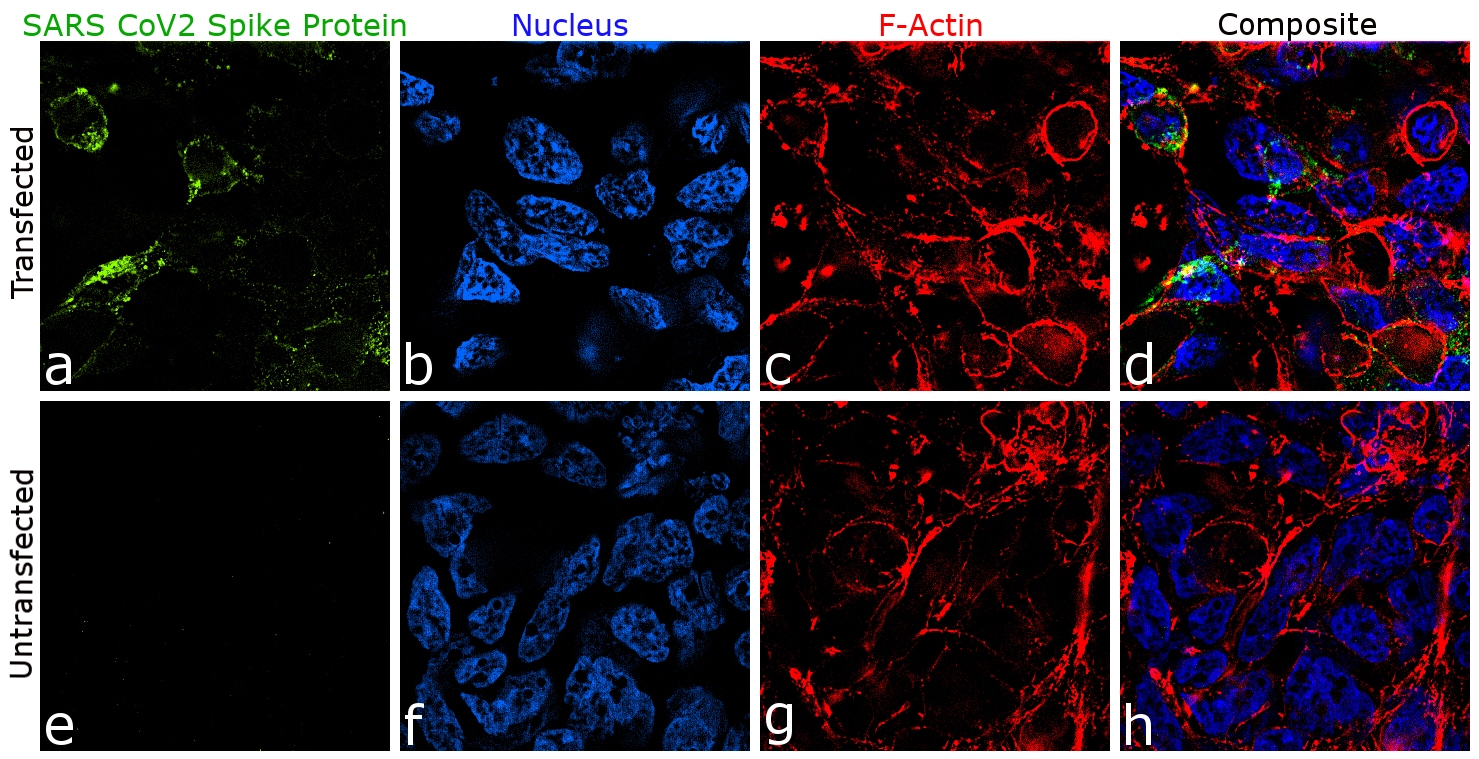 SARS-CoV-2 Spike Protein (RBD) Antibody (703958)