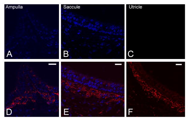 Connexin 26 Antibody (71-0500)