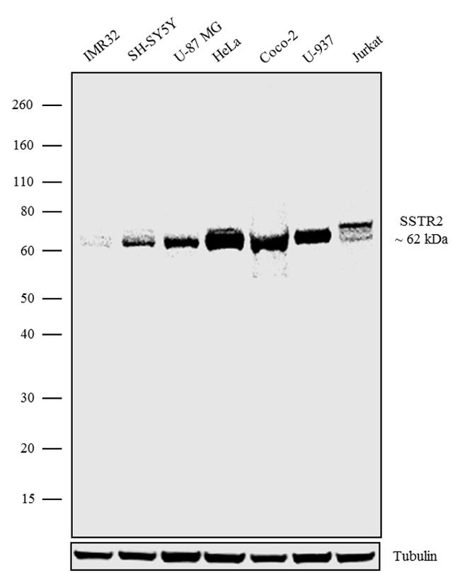 SSTR2 Antibody (711091)