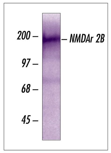 NMDAR2B Antibody (71-8600)