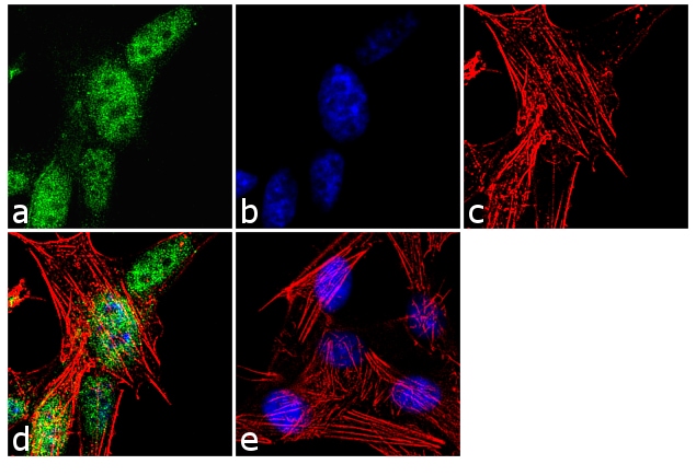 FOXP2 Antibody (720031)