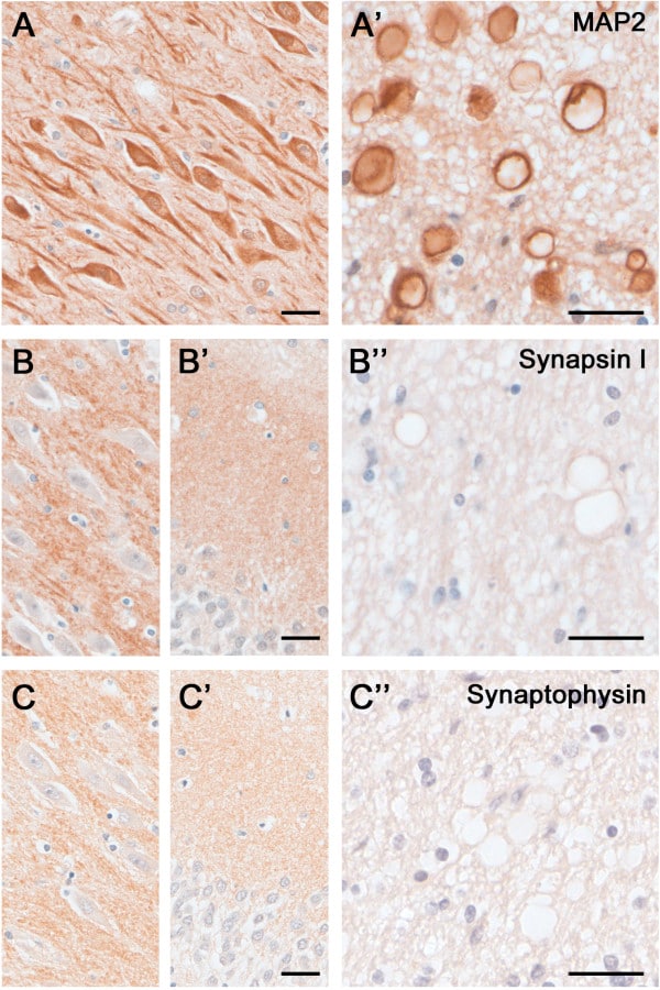 Synapsin 1 Antibody (A-6442)
