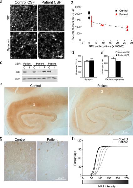 NMDAR2A Antibody (A-6473)