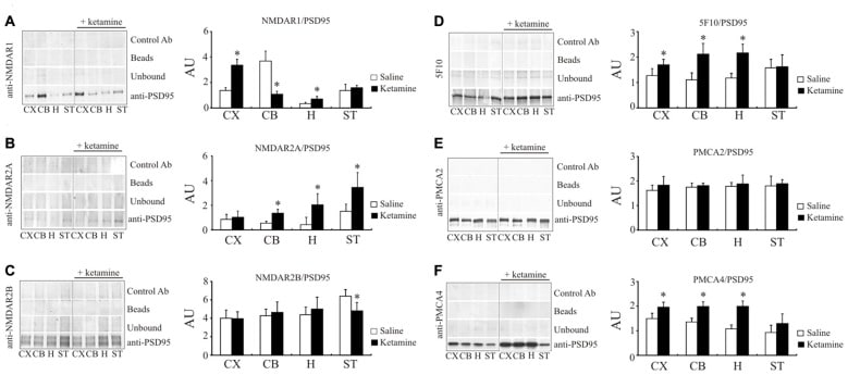 NMDAR2A Antibody (A-6473)