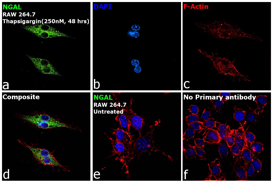 NGAL Antibody (ABS 043-29-02)
