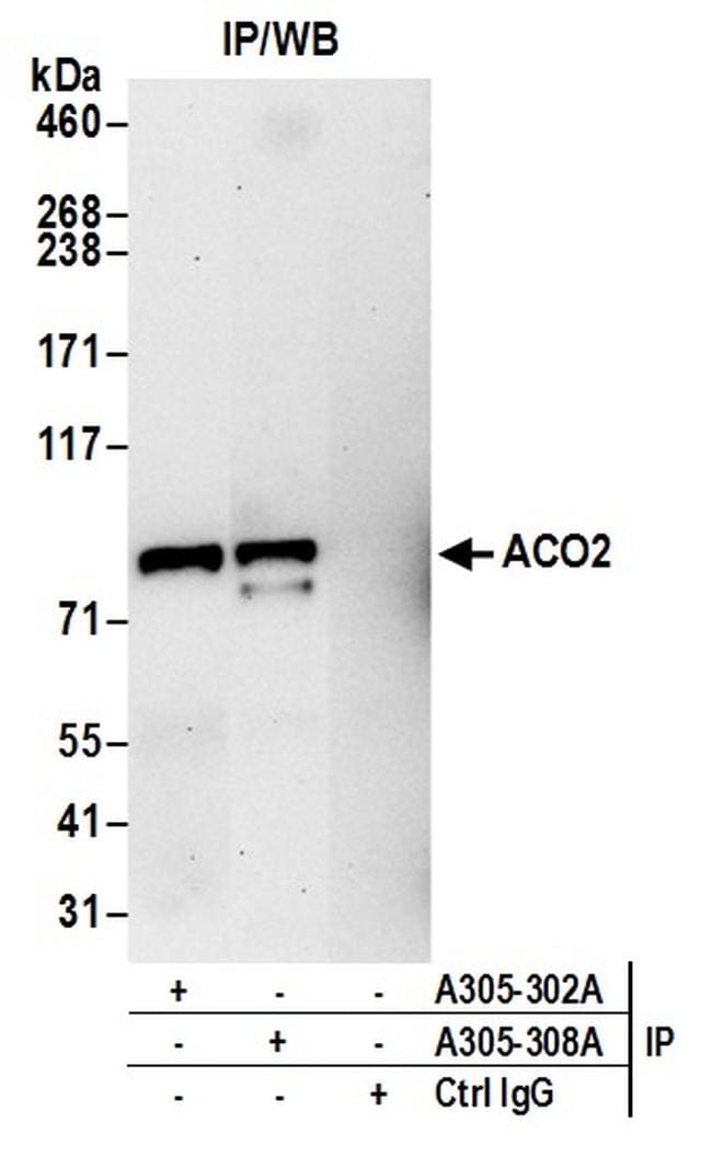 ACO2/Aconitase Antibody (A305-308A)