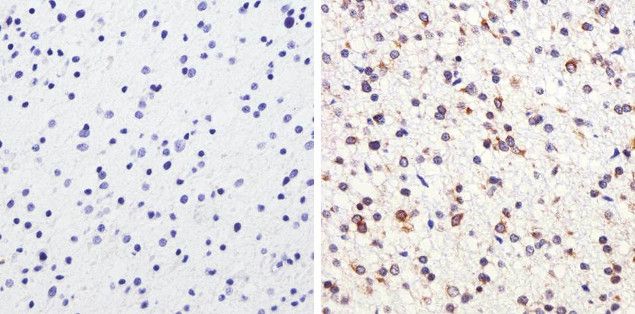 Tau Antibody (AHB0042)