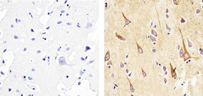 alpha Synuclein Antibody (AHB0261)