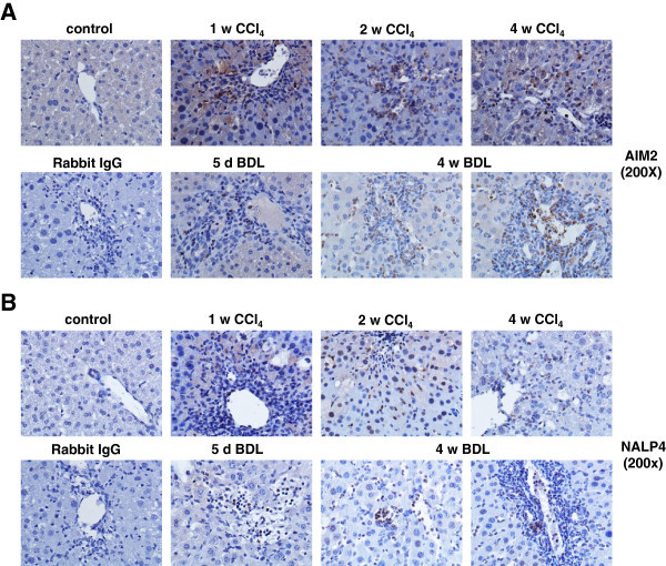 AIM2 Antibody (14-6008-93)