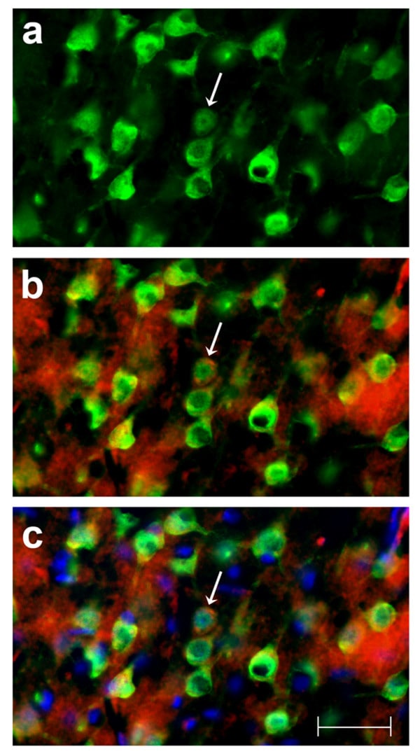 TNF alpha Antibody (AMC3012)