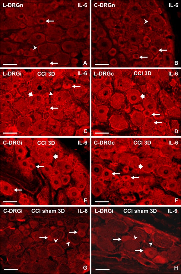 IL-6 Antibody (ARC0962)
