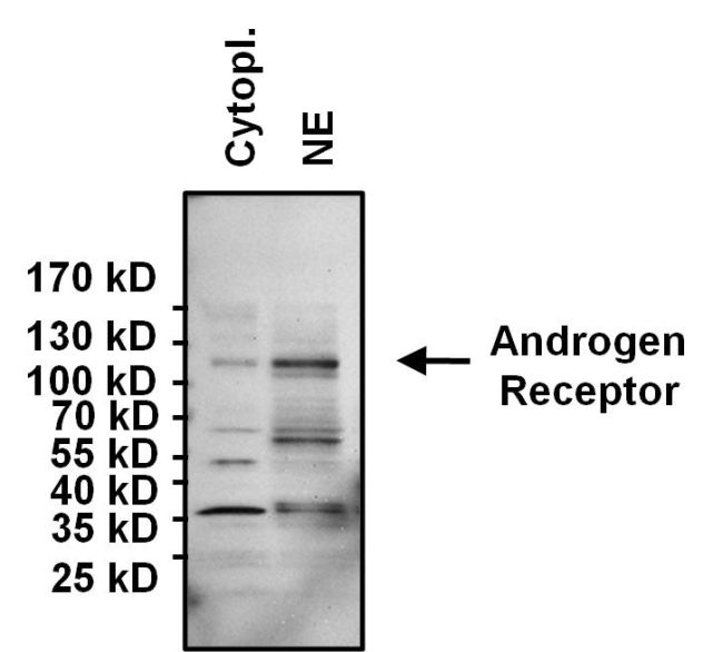 Androgen Receptor Antibody (MA5-13426)