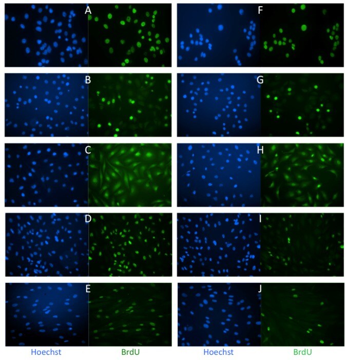 BrdU Antibody (B35128)