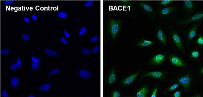 BACE1 Antibody (MA1-177)