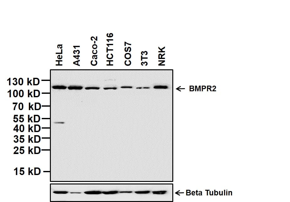 BMPR2 Antibody (MA5-15827)