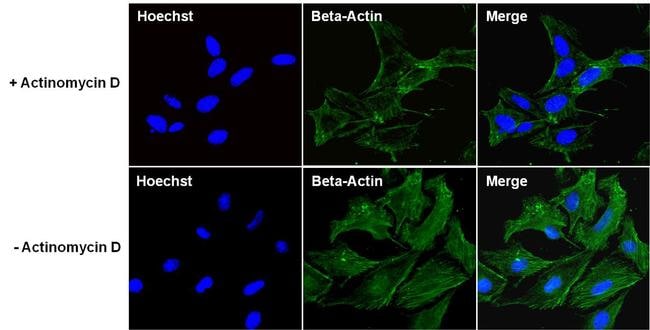 beta Actin Antibody (MA1-140)
