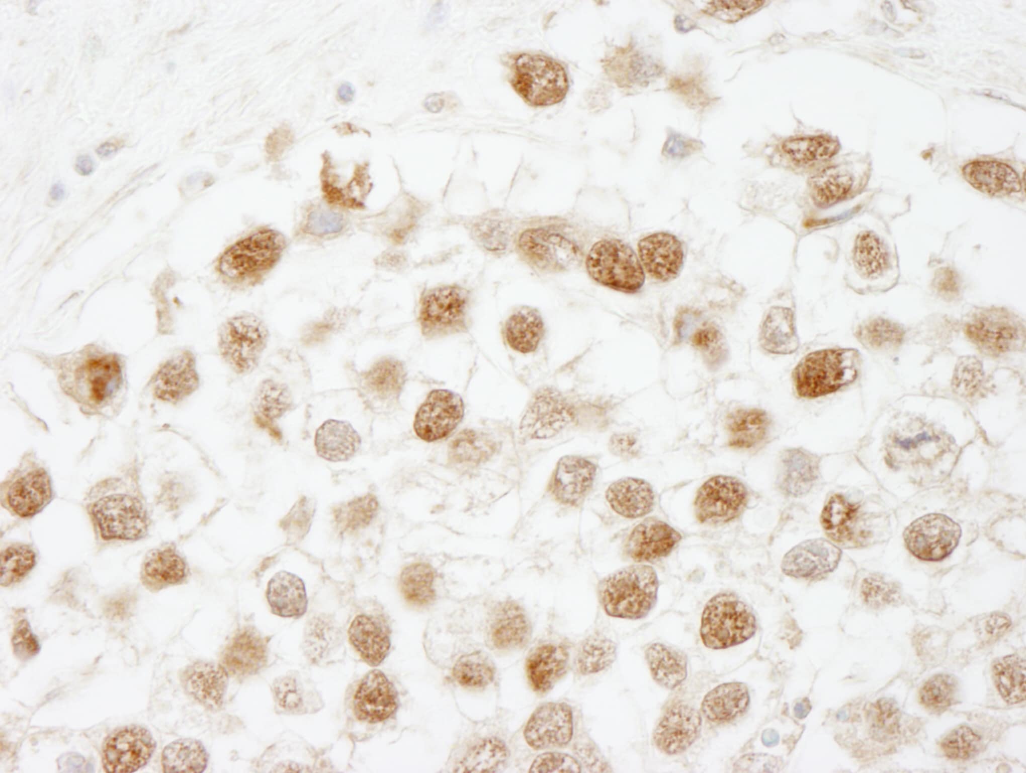 CAF-1 p60 Antibody (IHC-00227)