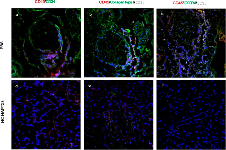 CD45 Antibody (14-0451-82)