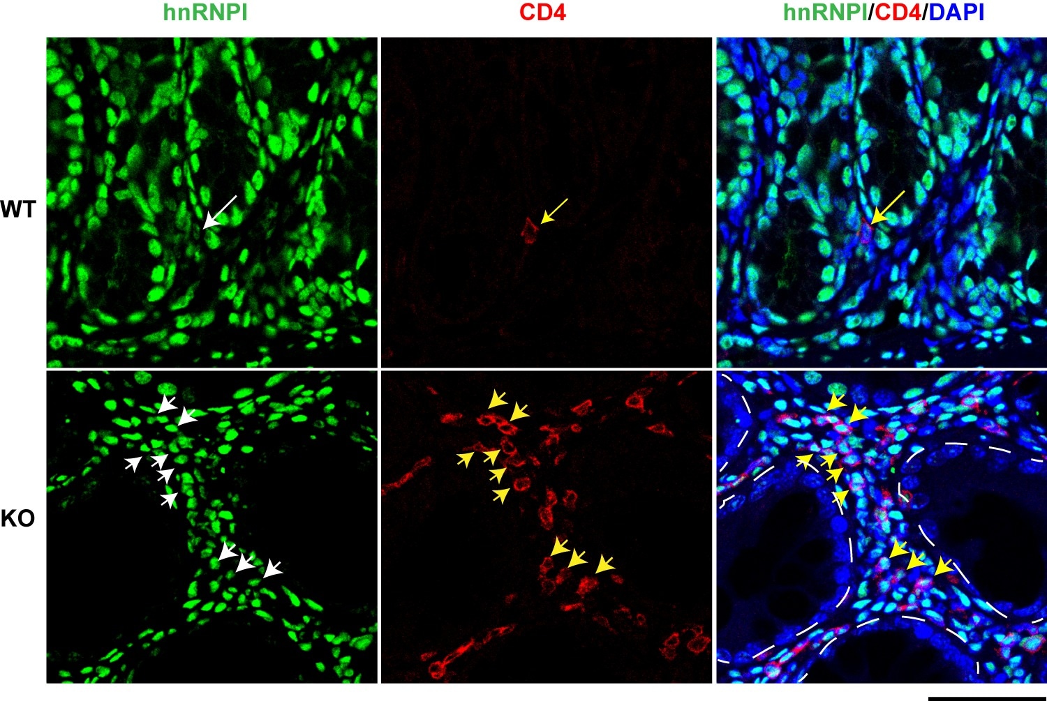CD4 Antibody (14-9766-82)