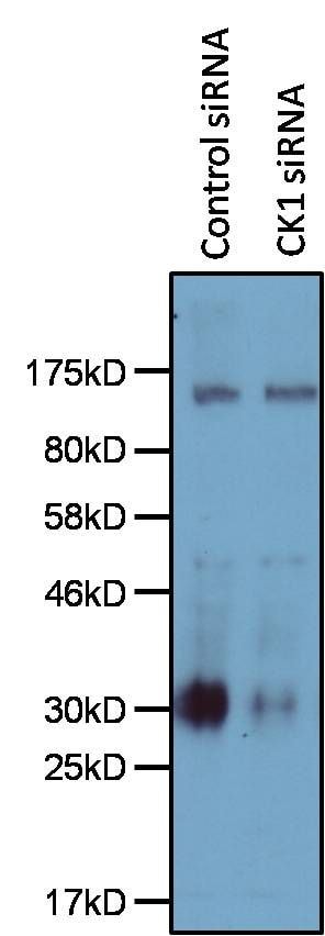 CK1 alpha Antibody (PA5-17536)