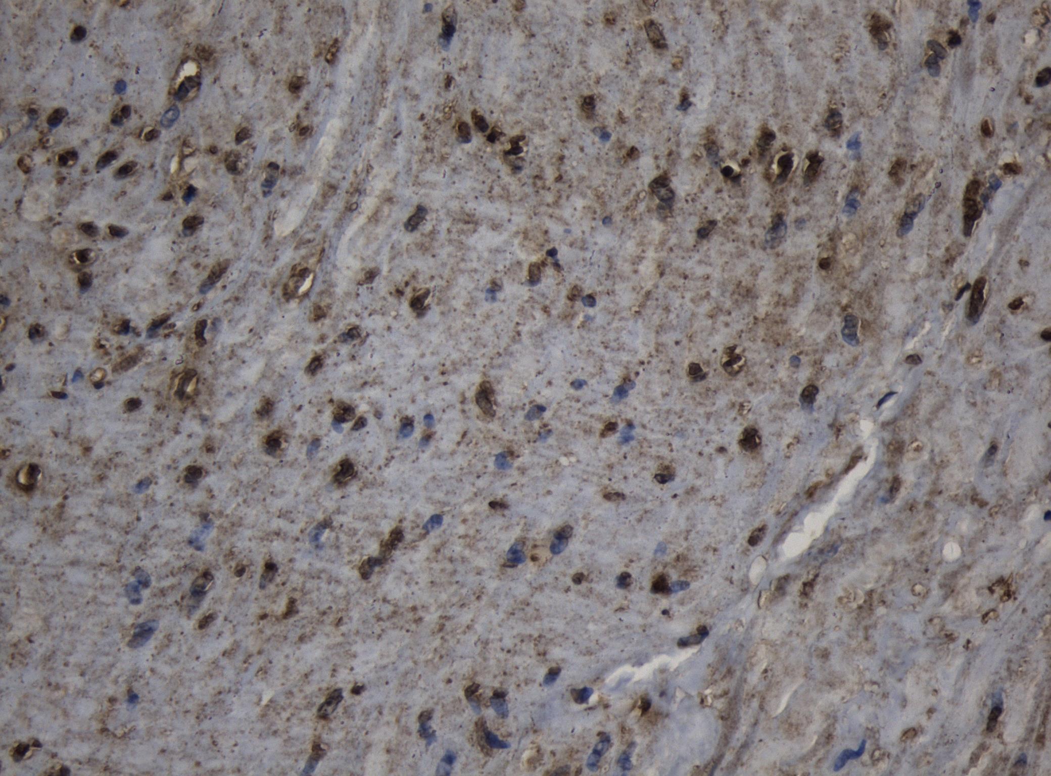 CPT1B Antibody (TA810598)