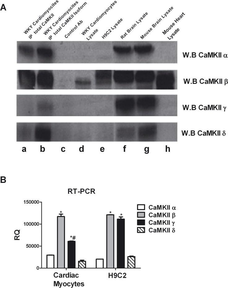 CaMKII beta Antibody (13-9800)