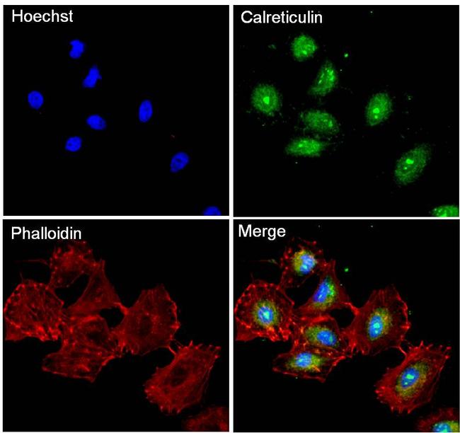 Calreticulin Antibody (MA5-15382)