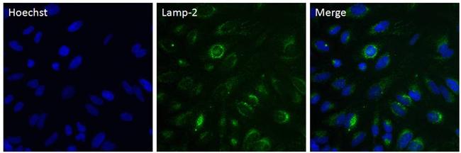 LAMP2 Antibody (MA1-205)