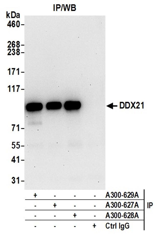 DDX21 Antibody (A300-629A)