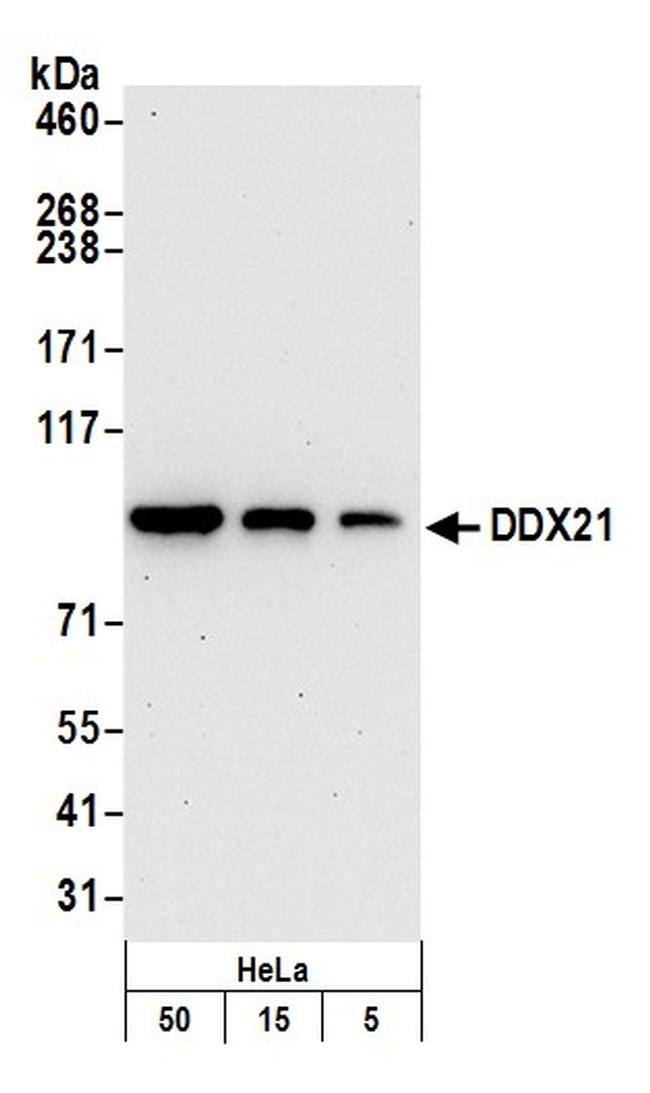 DDX21 Antibody (A300-629A)