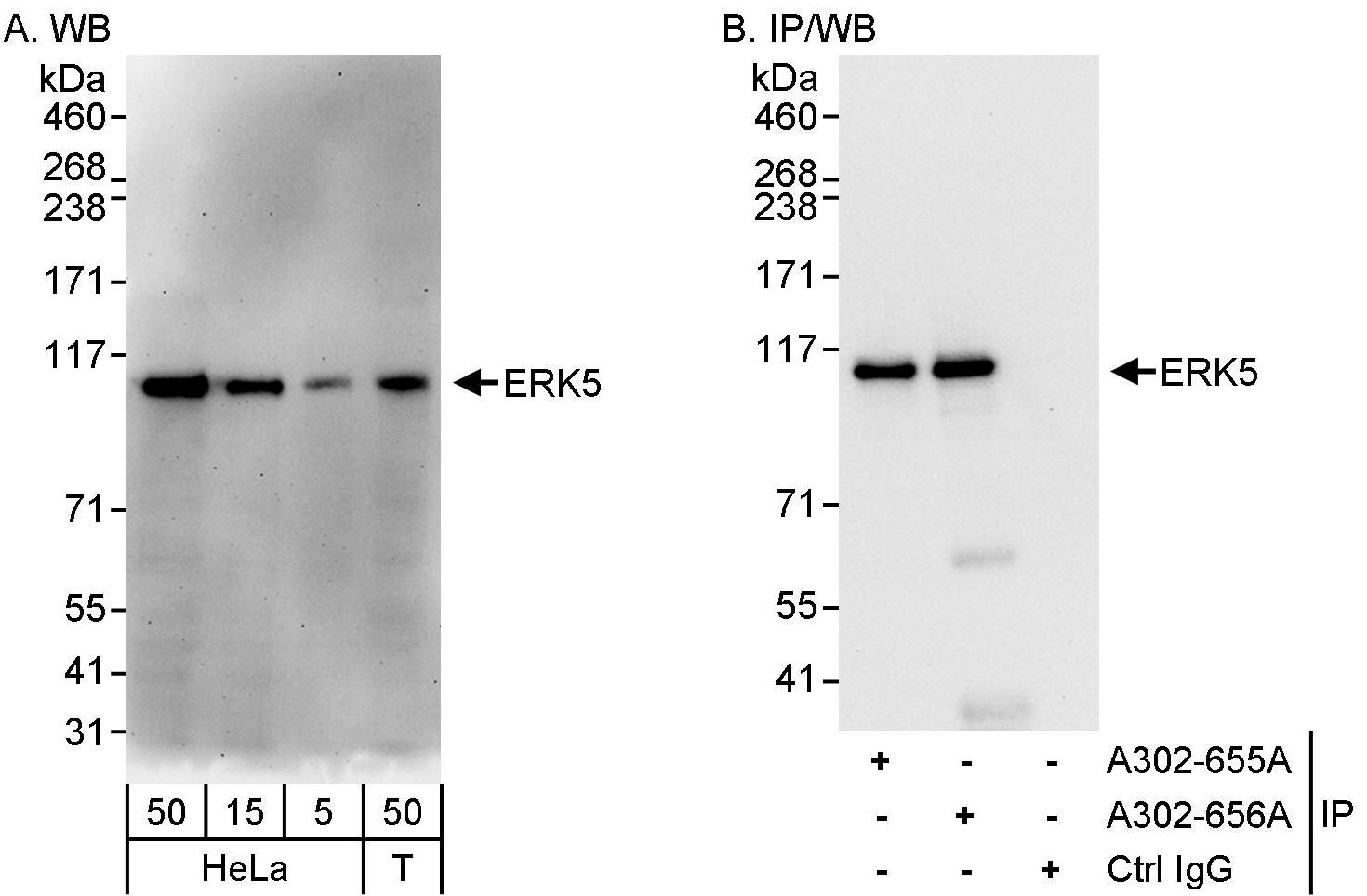 ERK5 Antibody (A302-656A)