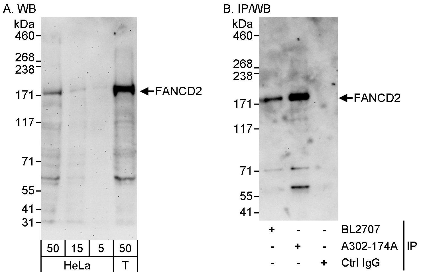 FANCD2 Antibody (A302-174A)