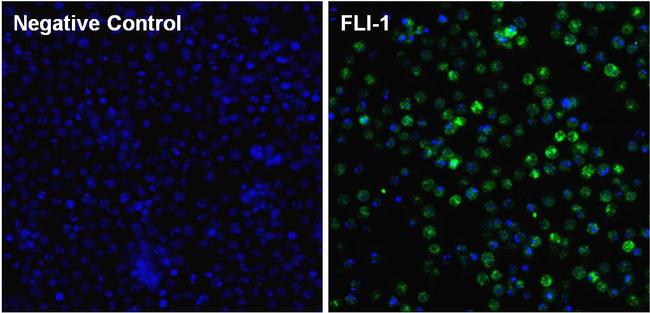 FLI1 Antibody (MA1-196)