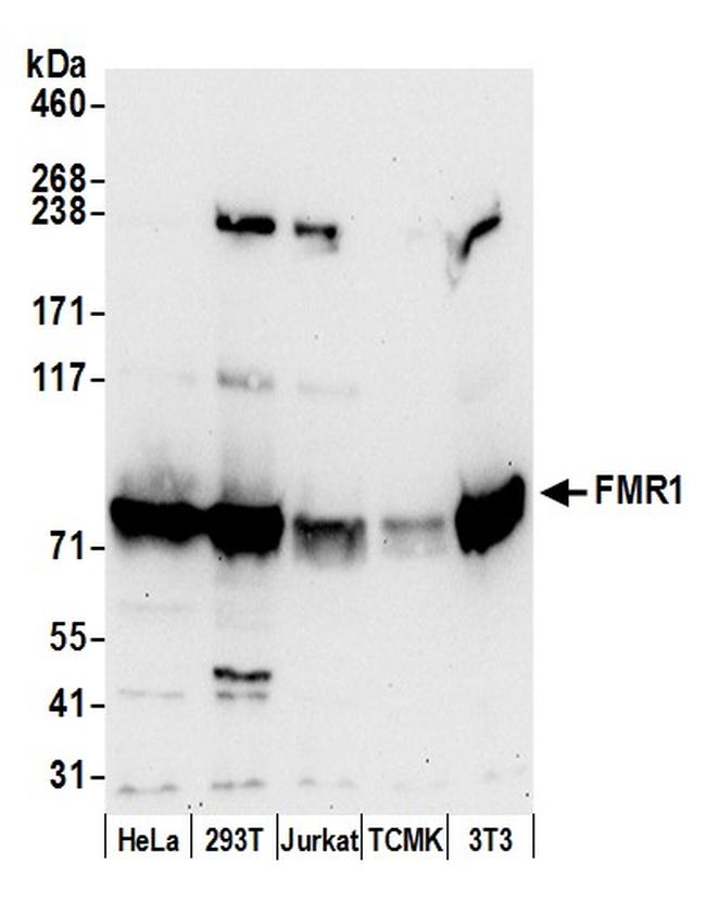 FMR1/FMRP Antibody (A305-199A)