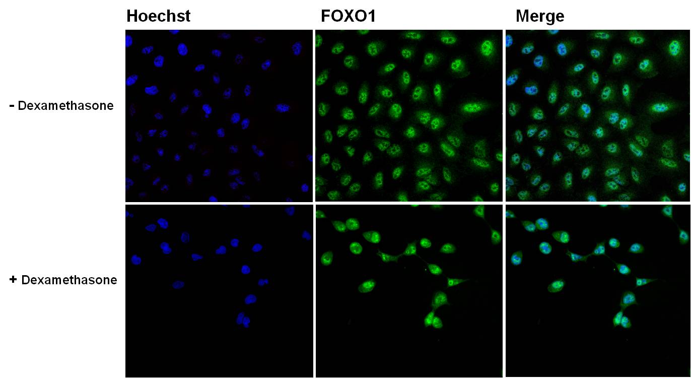 FOXO1 Antibody (MA5-17078)