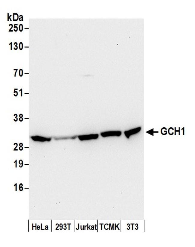 GCH1 Antibody (A305-296A-M)