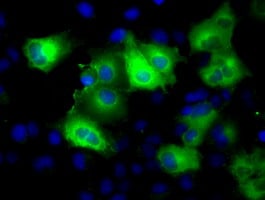 GLUL Antibody (CF500700)