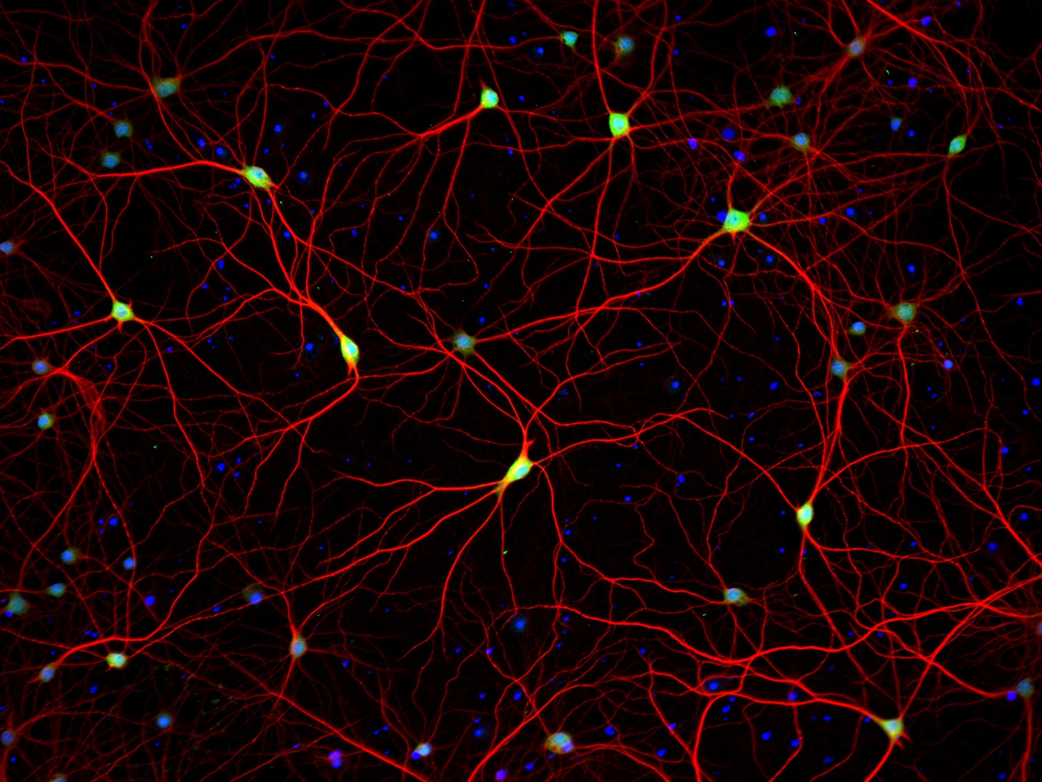 HuC/HuD Antibody (A-21271)
