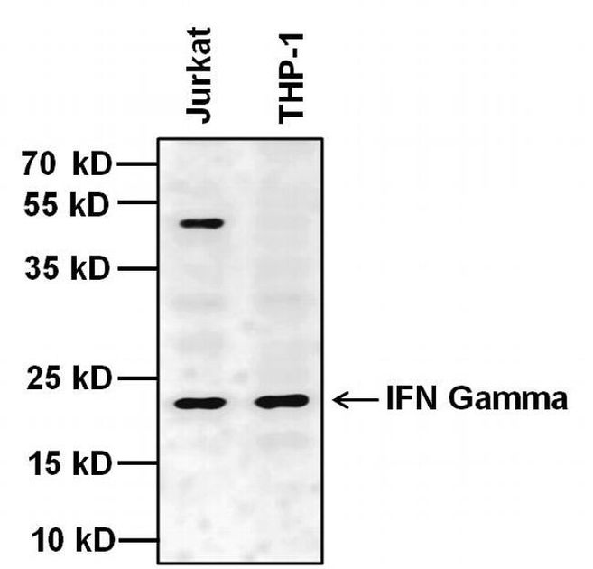 IFN gamma Antibody, Biotin (MM700B)