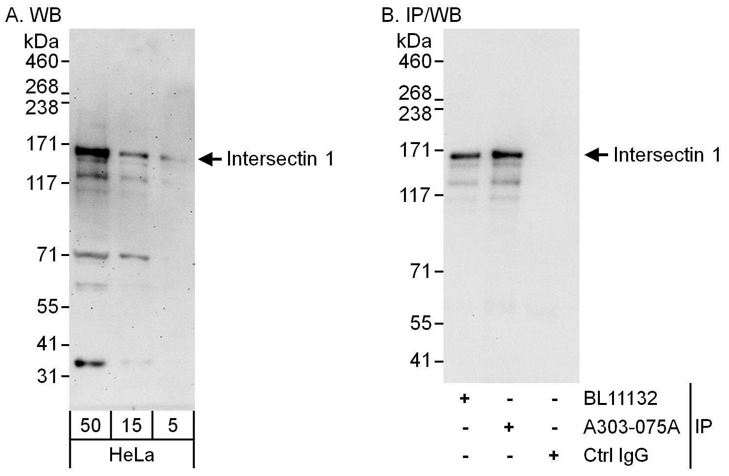 Intersectin 1 Antibody (A303-075A)