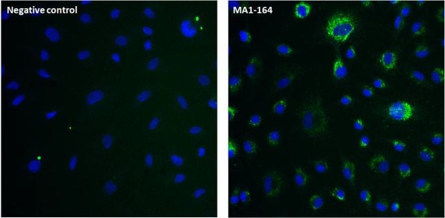 LAMP1 Antibody (MA1-164)
