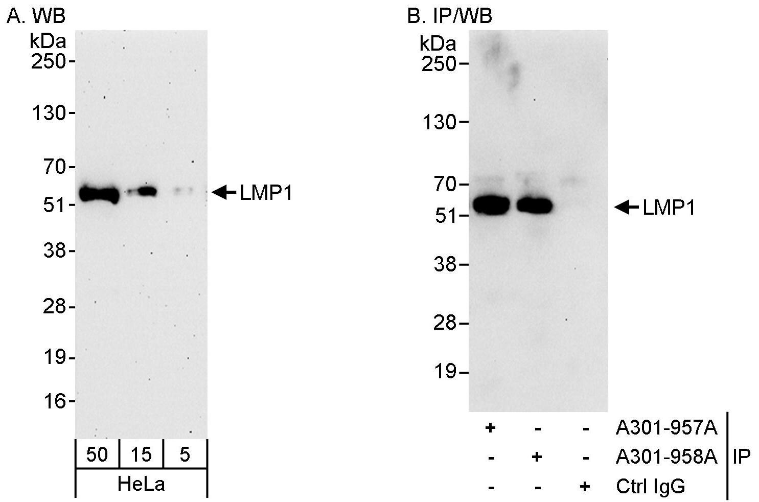 LMP1 Antibody (A301-958A)